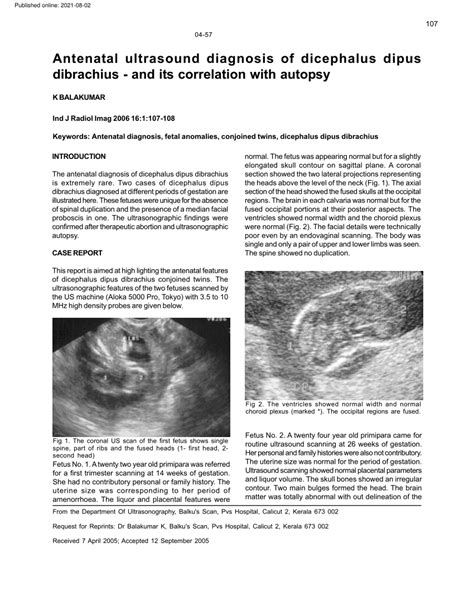 Pdf Antenatal Ultrasound Diagnosis Of Dicephalus Dipus Dibrachius And Its Correlation With