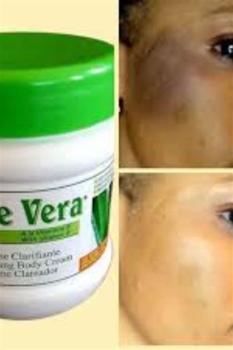 Aloe Vera Brightening Face Cream For Dark Spots And Sun Burn In Nairobi