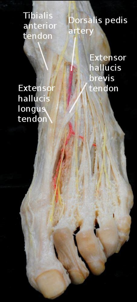 Anterior Tibial Artery Cadaver