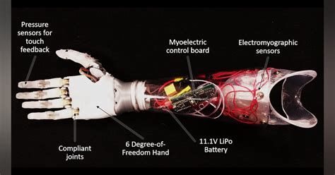 Bionic Hand Provides Strength And Haptic Feedback Electronic Design