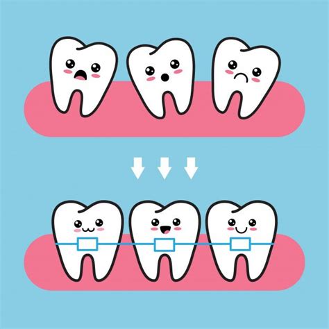 Шүдний аппарат зүүхээр төлөвлөсөн хүнд зөвлөх 8 зүйл Индранил Дентал
