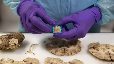 Whats Wrong With Growing Blobs Of Brain Tissue The Atlantic