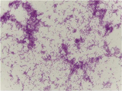 Lactobacillus Gram Stain