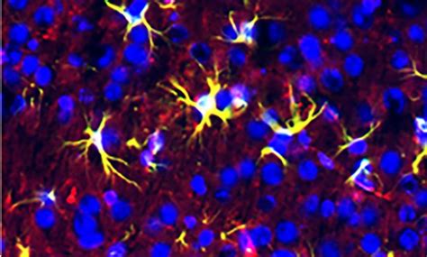 Toxicological Sciences On Linkedin Toxscicover