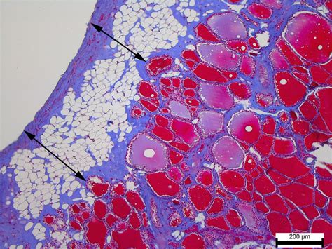 Fragment Of Thyroid Gland Of Nt Rabbit Capsule Arrows Heidenhains