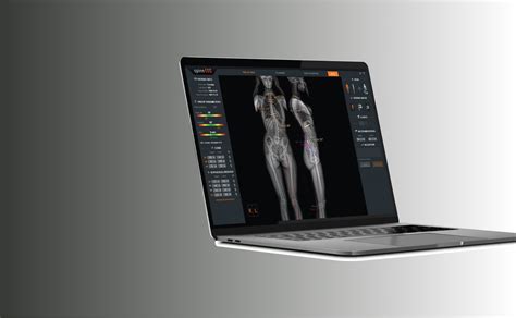 Quantified Global Alignment Atec Spine