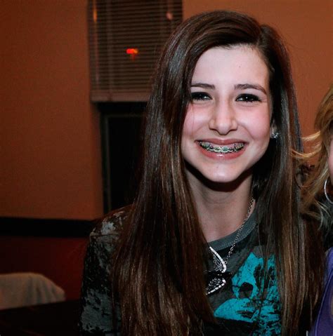 Girls With Braces On Twitter Show The Color Of Your Braces By Giving