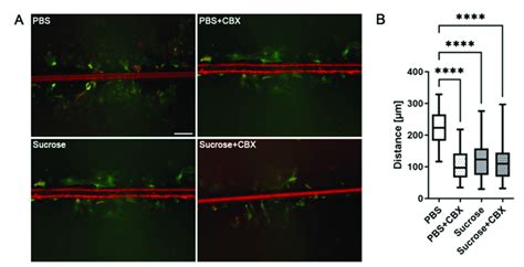 Sucrose Inhibits Gap Junctional Intercellular Communication Gjic To Download Scientific