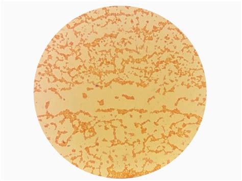 Lab Simple Staining Method Flashcards Quizlet