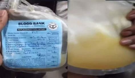 Probe Ordered Dengue Patient Allegedly Put On Mosambi Juice Drip