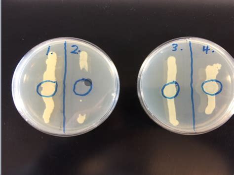 Lab Microbiology Flashcards Quizlet