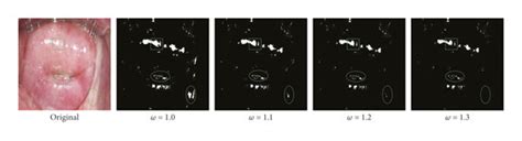Comparison Of Local Detection Threshold Coefficients Download