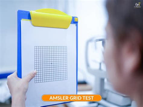 What Is Amsler Grid Eye Test Usage Cost And Alternatives