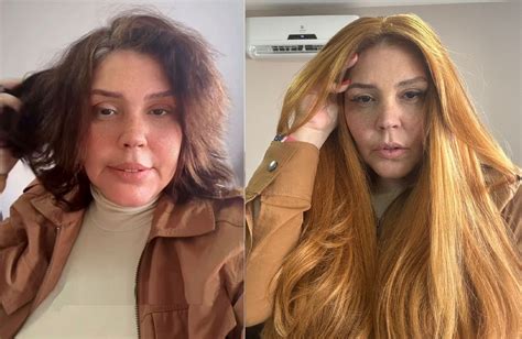 Simony celebra crescimento do cabelo após tratamento de câncer e