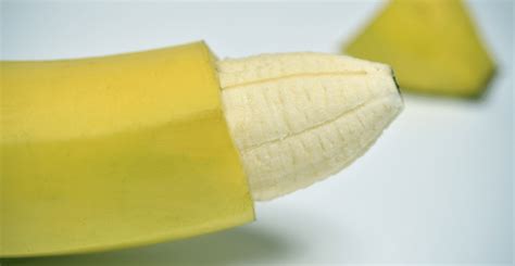 Ciri Ciri Luka Sunat Mau Sembuh Ecommerce Layanan Kesehatan