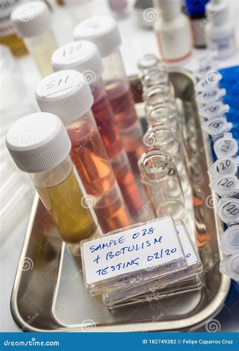 Samples Contaminated By Clostridium Botulinum Toxin That Causes Botulism In Humans Laboratory