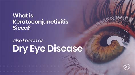 What Is Keratoconjunctivitis Sicca Dry Eye Disease Dryeye Rescue