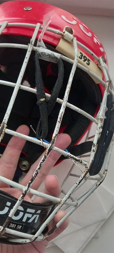 Will It Help Me To Pull The Maxilla Forward Its Just That Mewing