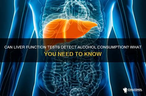 Can Liver Function Tests Detect Alcohol Consumption What You Need To