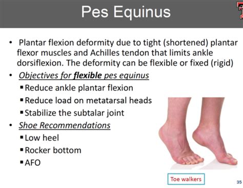 Foottoe Deformities Flashcards Quizlet