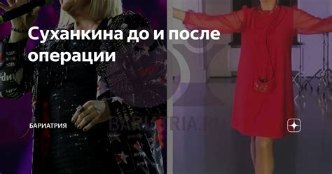 Суханкина до и после операции Бариатрия Дзен