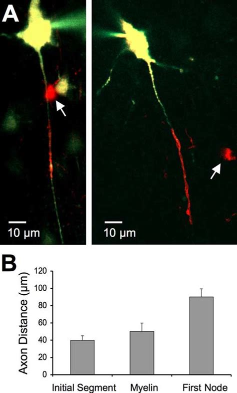Morphological Identification Of The Axon Initial Segment A Two Download Scientific Diagram