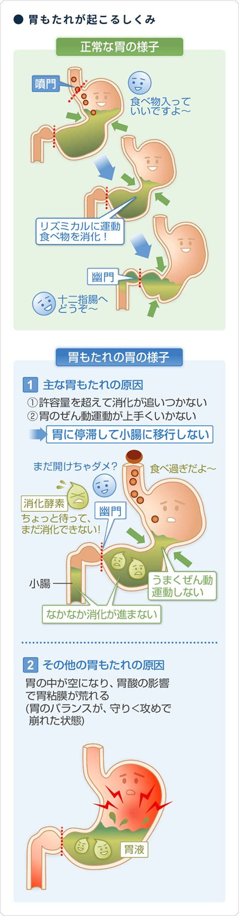 Q1 胃もたれの原因：加齢？ストレス？どうして胃もたれが起こるの？｜ 第一三共胃腸薬｜第一三共ヘルスケア