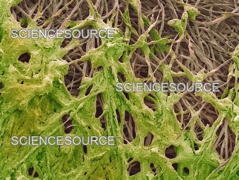 Ear Wax Under A Microscope Sem Stock Image Science Source Images