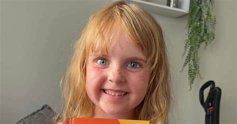 Darcee 5 Is Cover Star Of Book Explaining Her Skin Condition To Classmates The Irish News