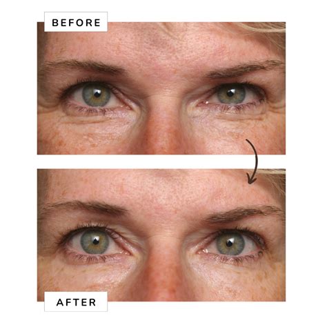 Eyelid Wrinkle Cream