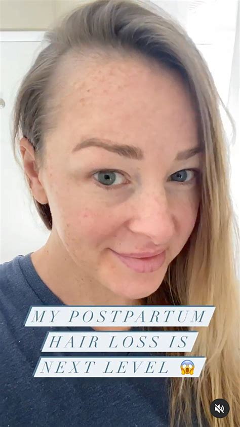 What Happened To Jamie Otis And Doug Hehner From Married At First Sight