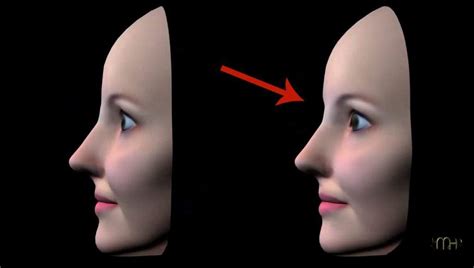 Cómo Detectar Si Alguien Padece Esquizofrenia O Psicosis Gracias A Este