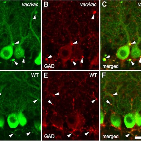 Early Onset Degeneration Of Purkinje Cell Axon Collaterals In The