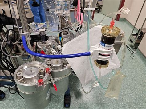 Jafron Hemoadsorption Jafron Biomedical