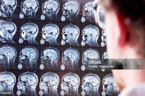 머리와 뇌의 Mri 스캔 전경에 있는 닥터는 초점에 있는 배경에 있는 환자의 두뇌의 자기 공명 화상 진 찰에 보이는 흐리게 한