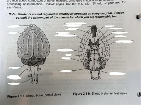 Diagram Of A P Brain Diagram Lab 2 Quizlet
