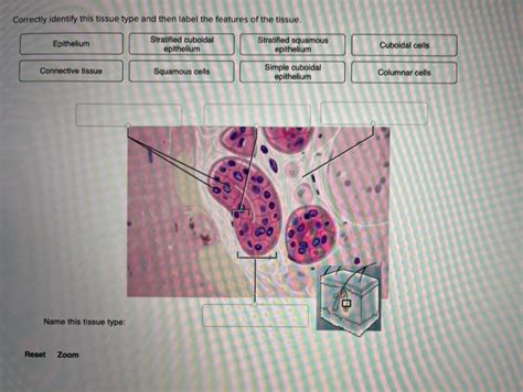 Solved Correctly Identify This Tissue Type And Then Label Chegg