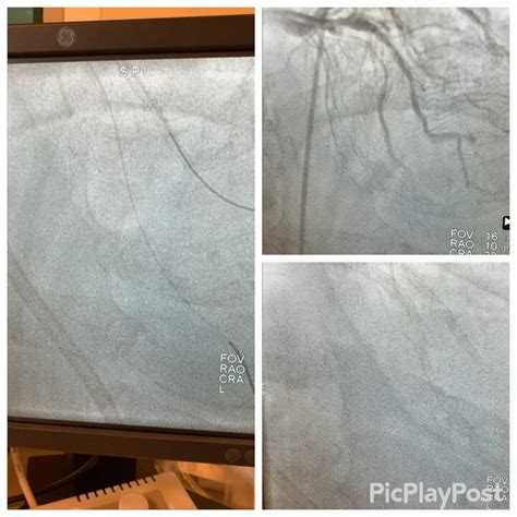 Augusto Daige On Linkedin Catrx