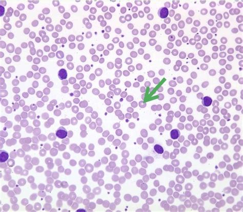 Blood Lab Flashcards Quizlet