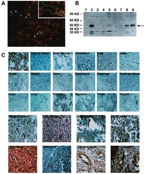 Legumain Is Overexpressed In Tumors A Doubly Stained Section Of Ct26