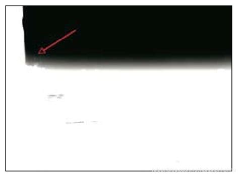 【红外dde算法】flir数字细节增强算法介绍文档解析红外图像增强 Csdn博客