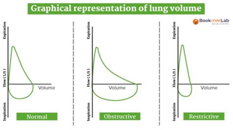 Pft Test Price Purpose Graph And Sample Report 2025 • Bookmerilab