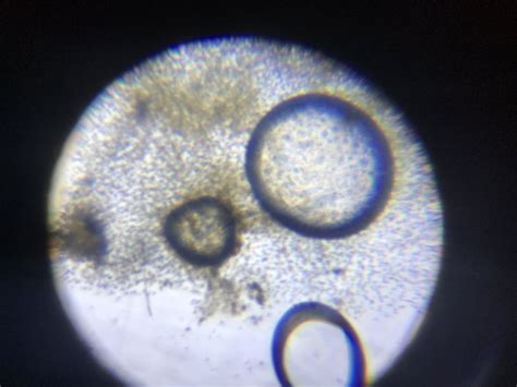Chrysophytes Help Me Cure It Page 9 Reef2reef Saltwater And Reef