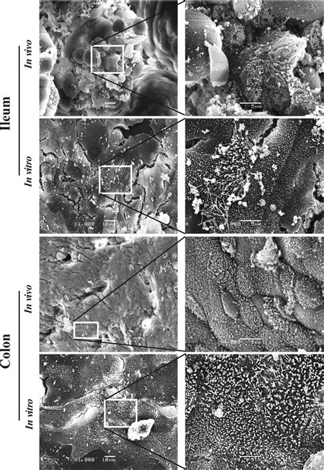 Scanning Electron Micrographs Of Ileum And Colon Epithelial Cells In