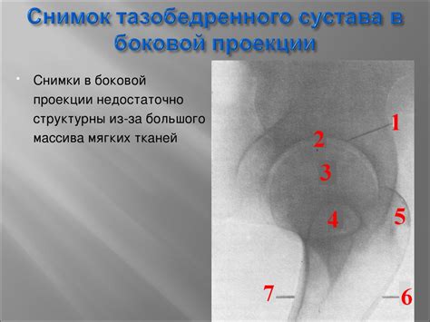 Рентгенологическое исследование тазобедренных суставов презентация онлайн