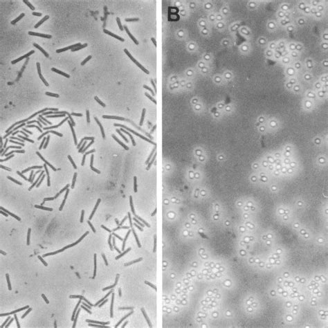 Regeneration And Transformation Frequencies Of B Thuringiensis