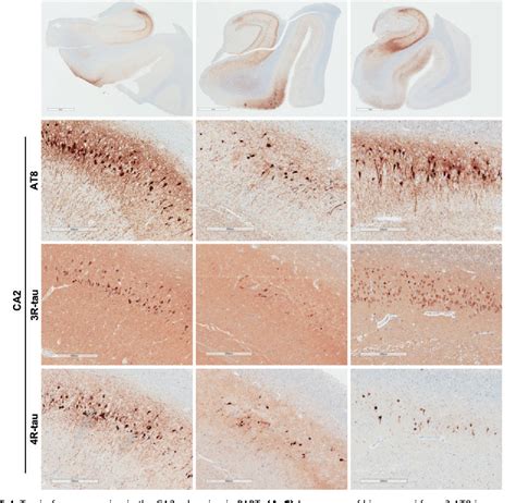 Figure 4 From Early Selective Vulnerability Of The Ca2 Hippocampal