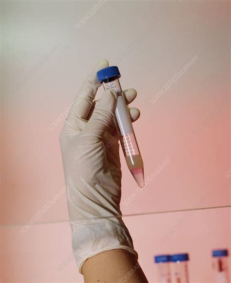 Centrifuged Semen For Ivf Stock Image M802 0225 Science Photo Library