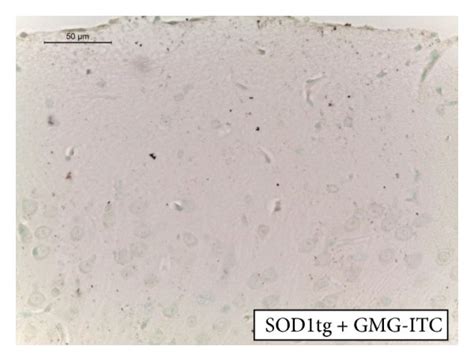Tunel Assay For Apoptosis Detection In Untreated Sod1tg Rats