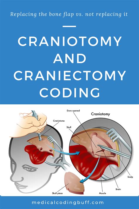 The Key To Craniotomy And Craniectomy Coding Cpt Coding Humor